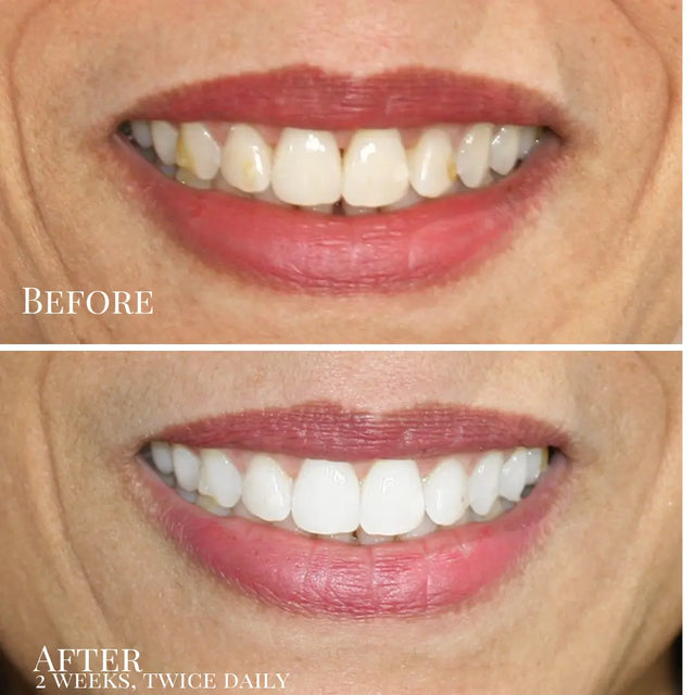 Carbon Power Clean Activated Carbon Toothpaste – intelliWHiTE